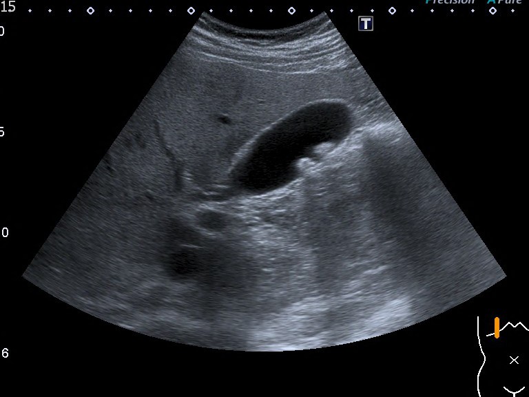 11. Tipos de transductores. – Ecografía Fácil