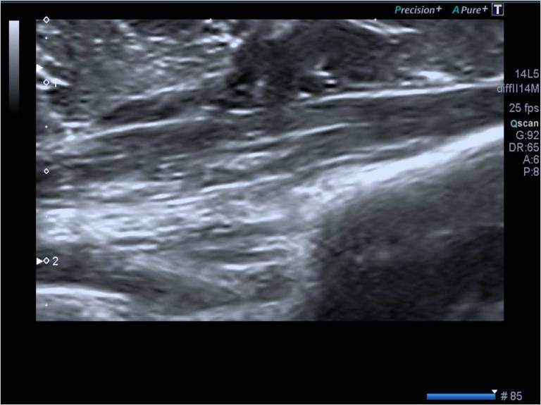19. El foco. – Ecografía Fácil