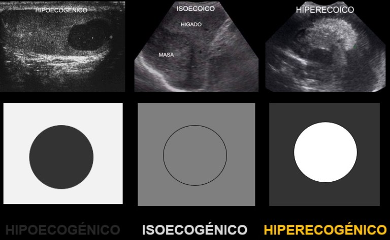 Isoecogénico – Ecografía Fácil