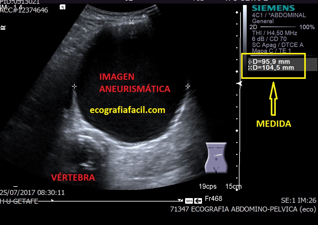 EcoFast – Ecografía Fácil