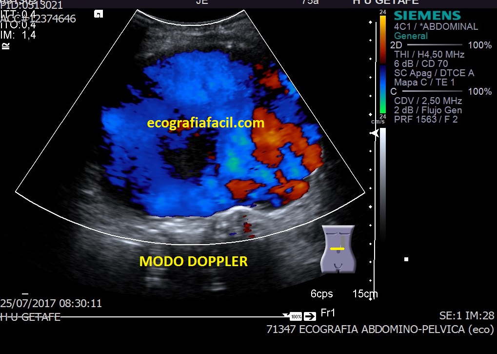 EcoFast – Ecografía Fácil