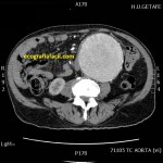 EcoFast – Ecografía Fácil