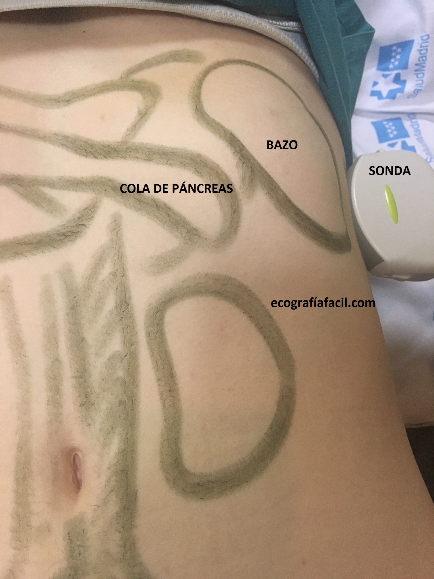 EcoFast – Ecografía Fácil