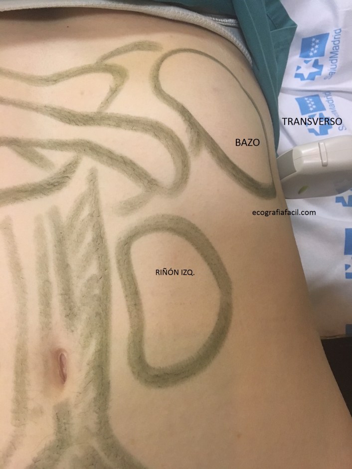 52. Protocolo de Abdomen. El Bazo. – Ecografía Fácil