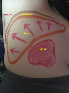 Ángulo Costofrénico – Ecografía Fácil