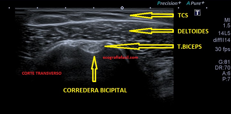 La Ecogenicidad – Ecografía Fácil