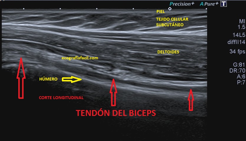 Hombro – Ecografía Fácil