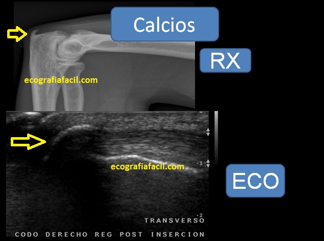 La Ecogenicidad – Ecografía Fácil
