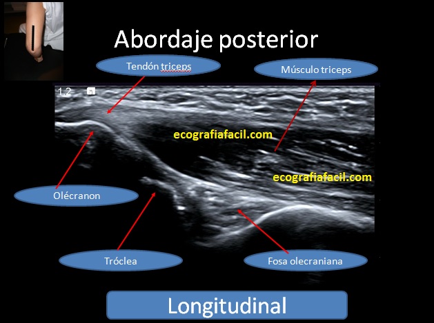 Codo – Ecografía Fácil