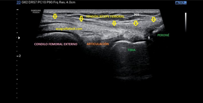 Longitudinal – Ecografía Fácil