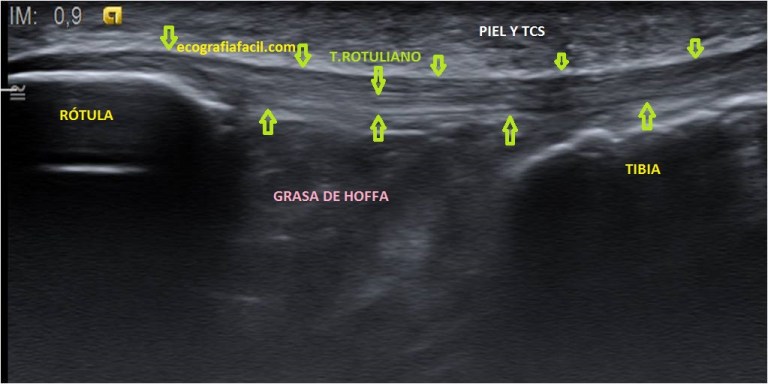 La Ecogenicidad – Ecografía Fácil