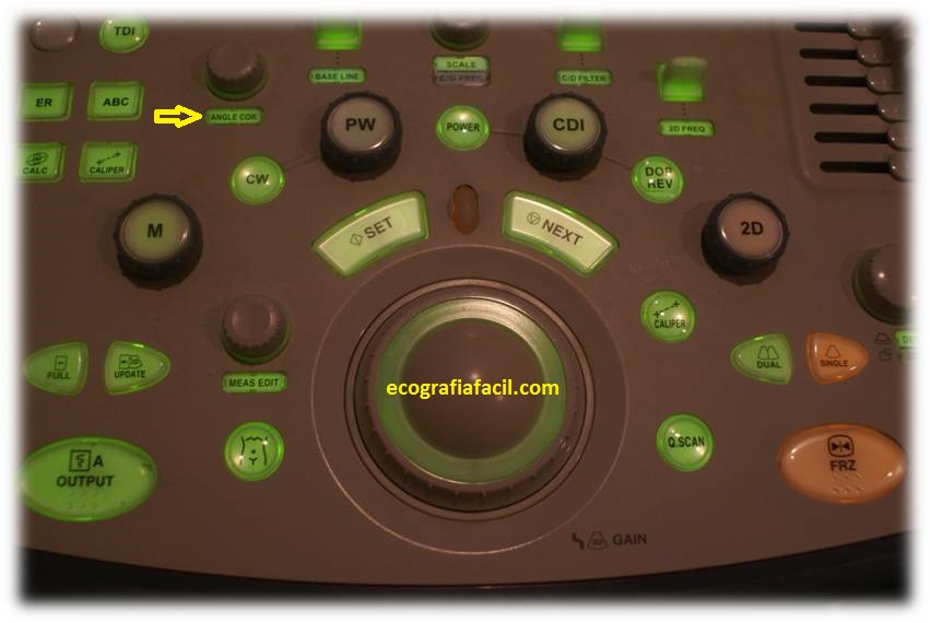 102. El Doppler.Nociones Básicas. Doppler Color. – Ecografía Fácil