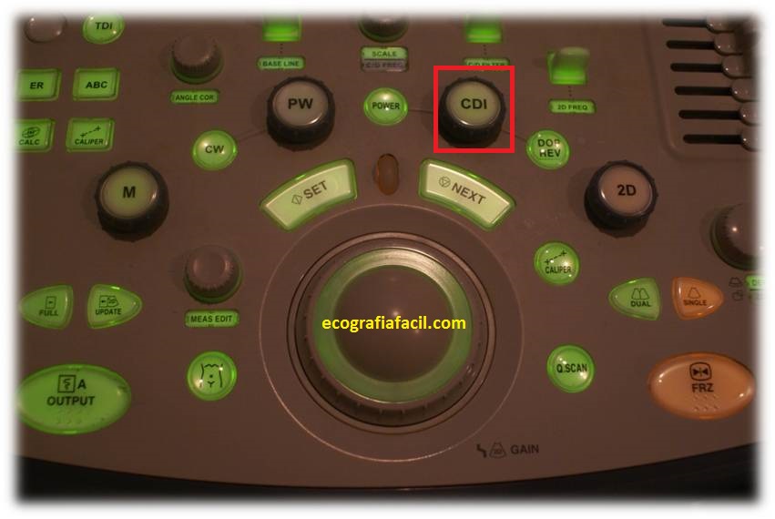 102. El Doppler.Nociones Básicas. Doppler Color. – Ecografía Fácil