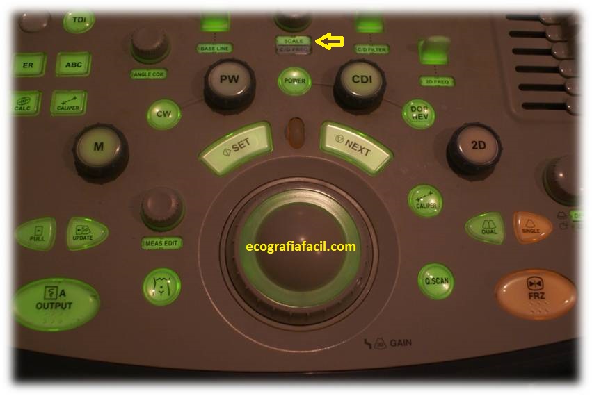 102. El Doppler.Nociones Básicas. Doppler Color. – Ecografía Fácil