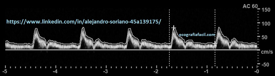 Línea Base – Ecografía Fácil