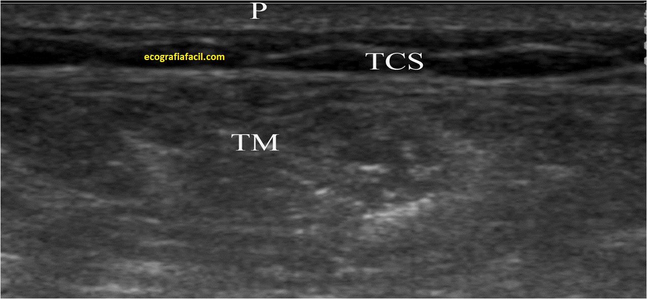 101. Ecografía de Partes Blandas. – Ecografía Fácil