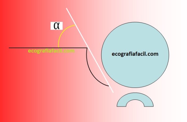 Cabeza de Fémur – Ecografía Fácil