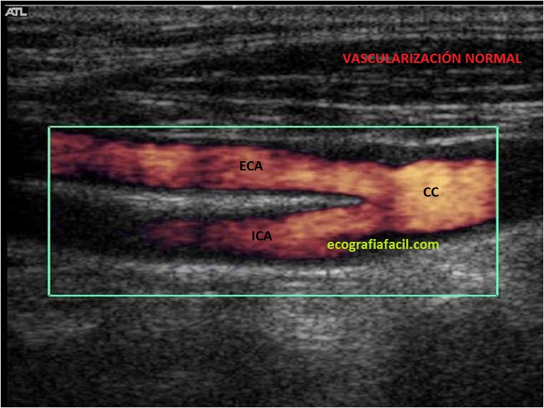 Viernes – Ecografía Fácil