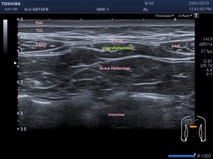 Isoecogénico – Ecografía Fácil