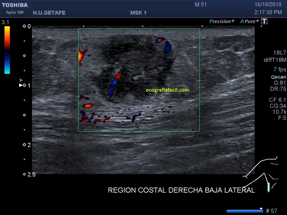 Share Wave – Ecografía Fácil