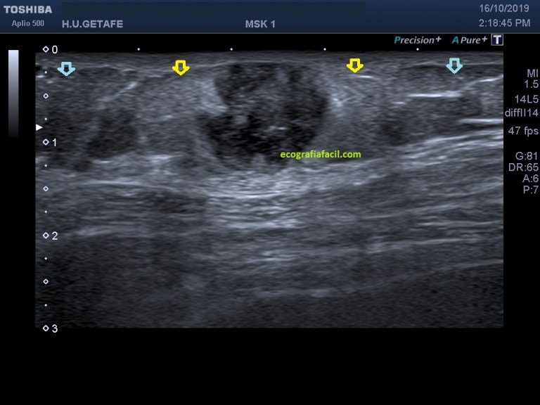Share Wave – Ecografía Fácil