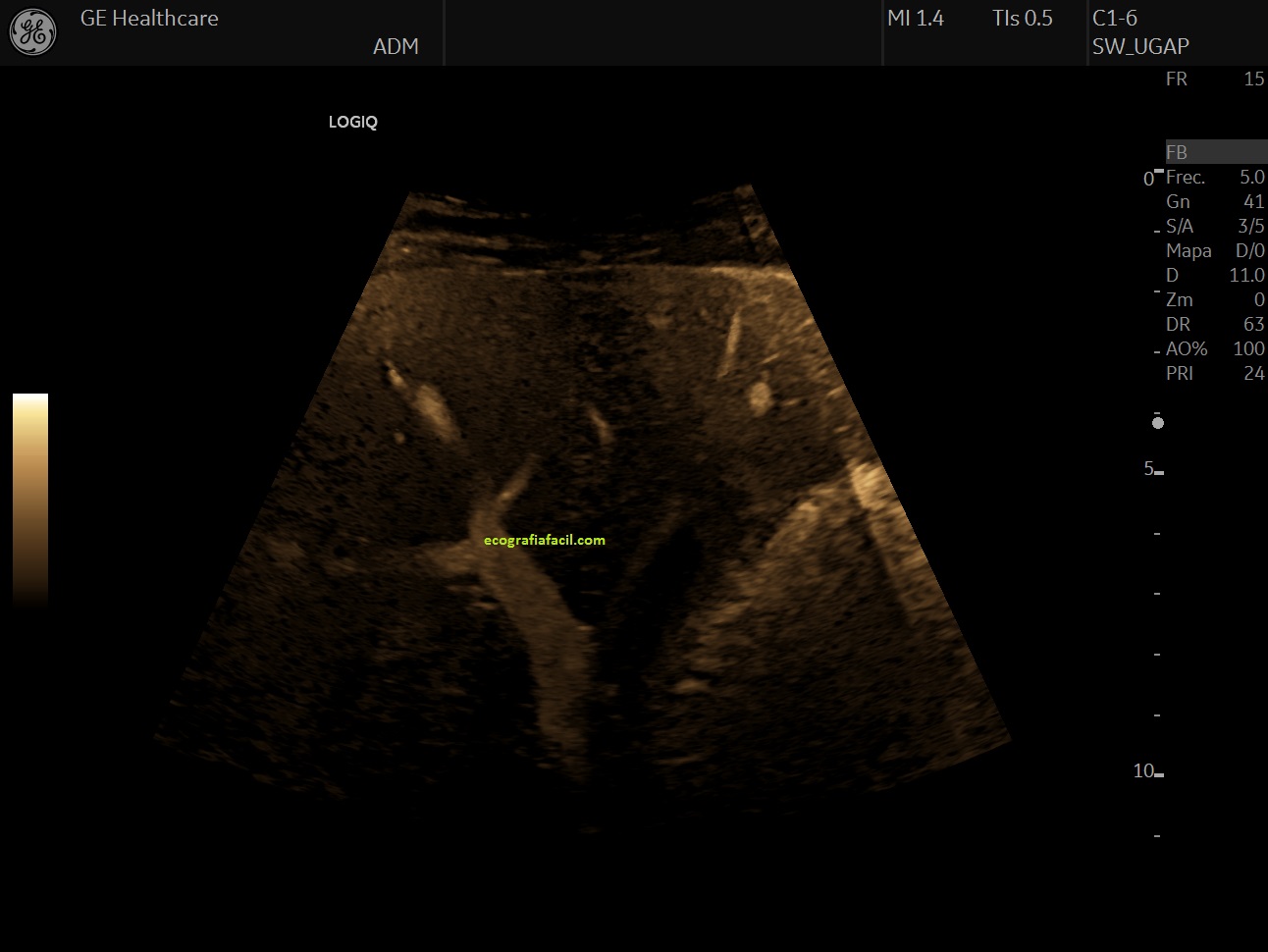 197. El Doppler y su evolución. – Ecografía Fácil