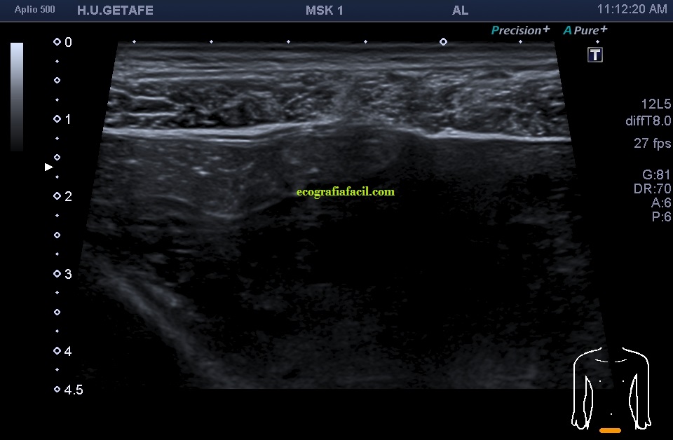 Ecografía Fácil – Página 16 – Blog de Ecografía básica.