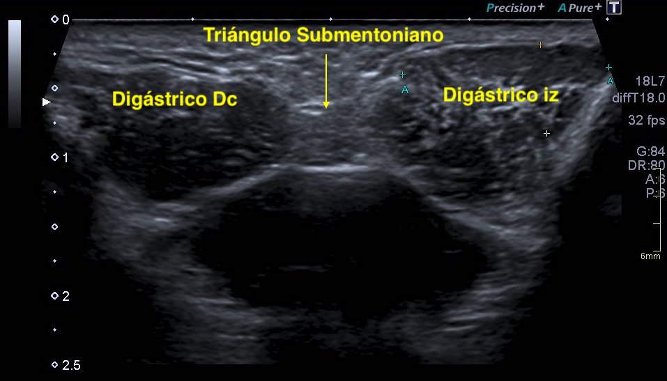264. El Músculo Digástrico. – Ecografía Fácil