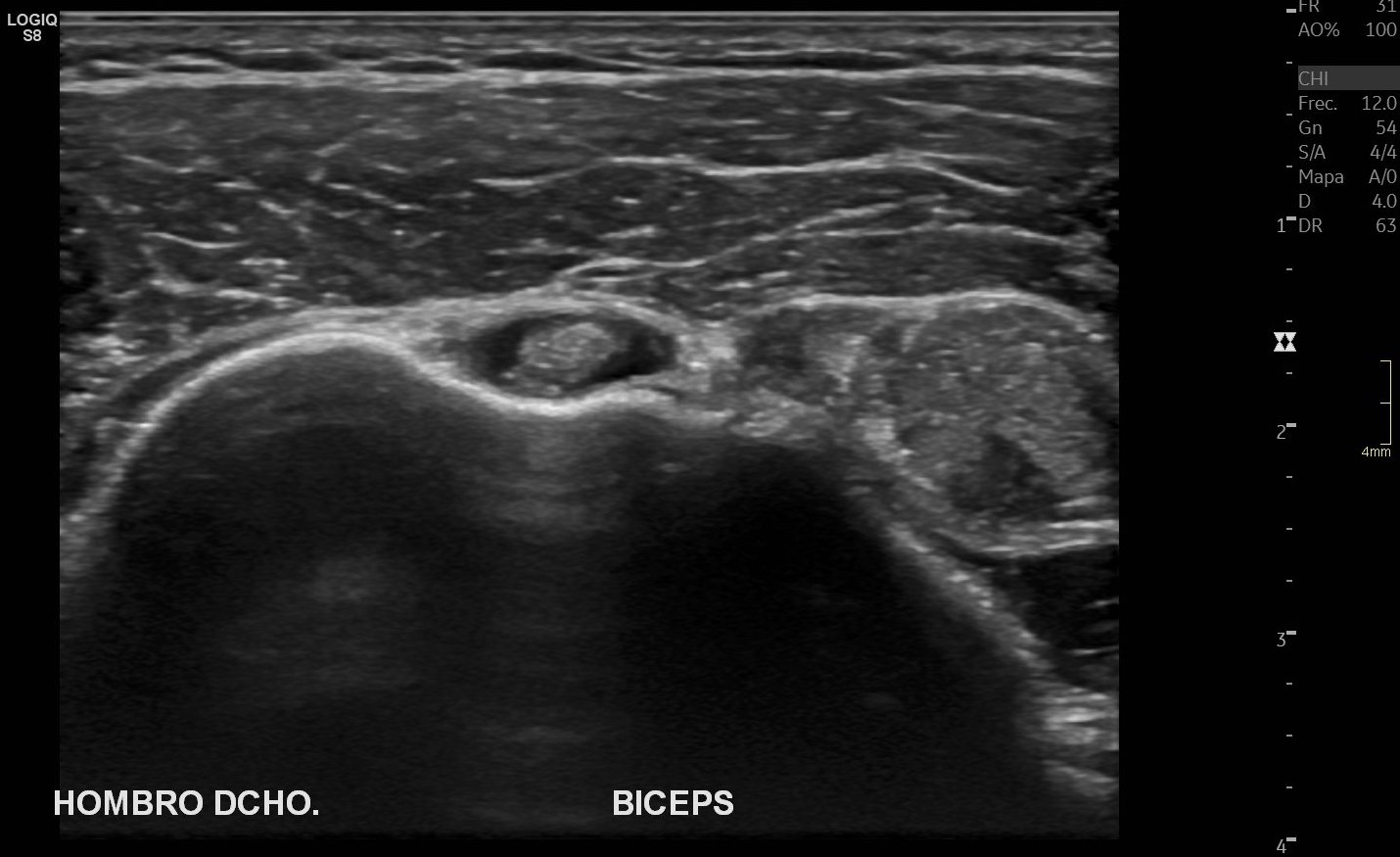 277. Hombro bonito – Ecografía Fácil