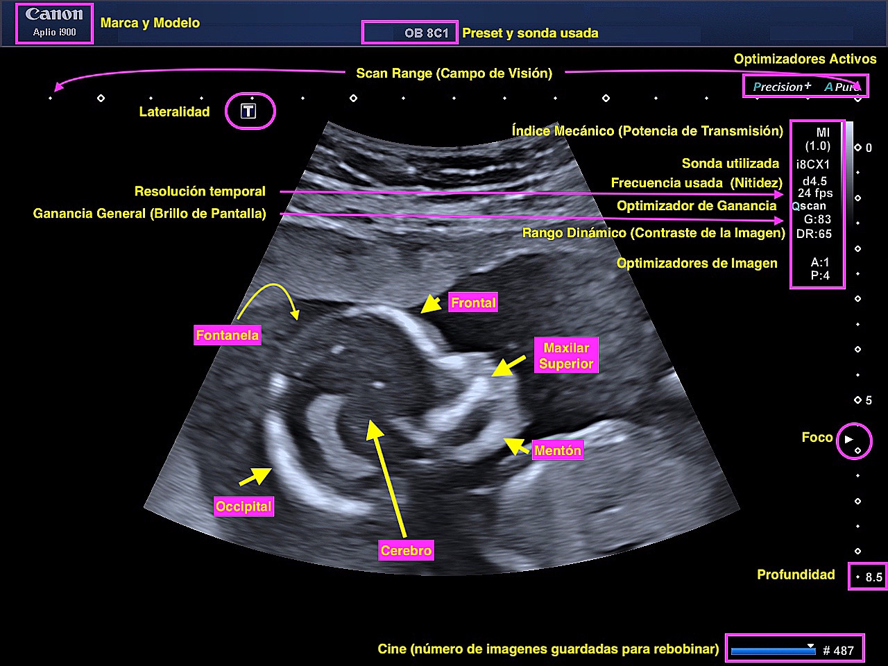 320. Lo que nos dice una imagen de eco y no sabemos… – Ecografía Fácil