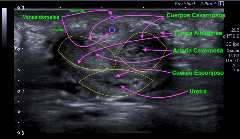 Pene – Ecografía Fácil