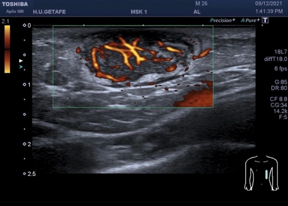348. Doppler. Tipos y técnicas. – Ecografía Fácil